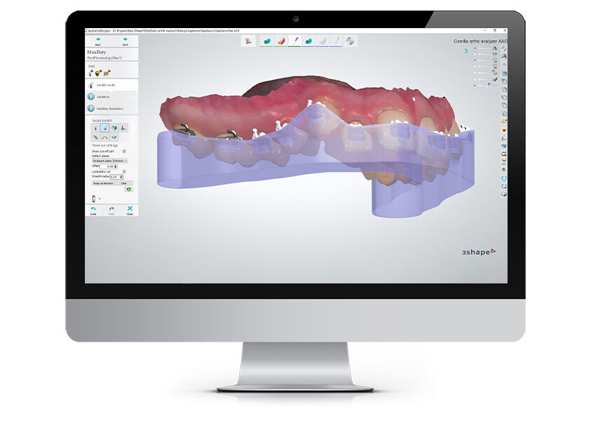 Indirect Bonding Studio*